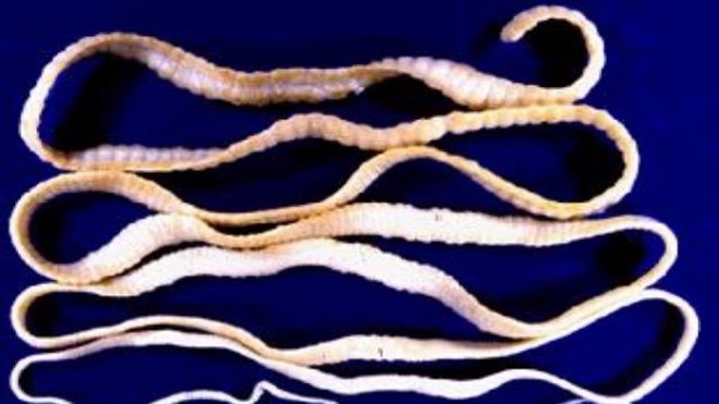 Uống thuốc xổ, con sán xơ mít dài hơn 2 mét chui ra khỏi người đàn ông