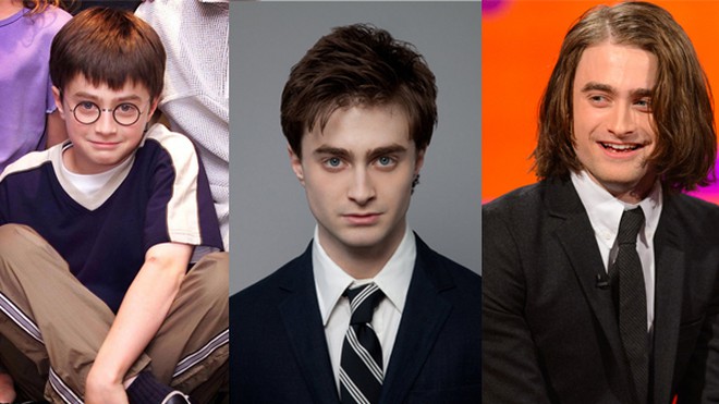 Choáng ngợp sự thay đổi của diễn viên film Harry Porter